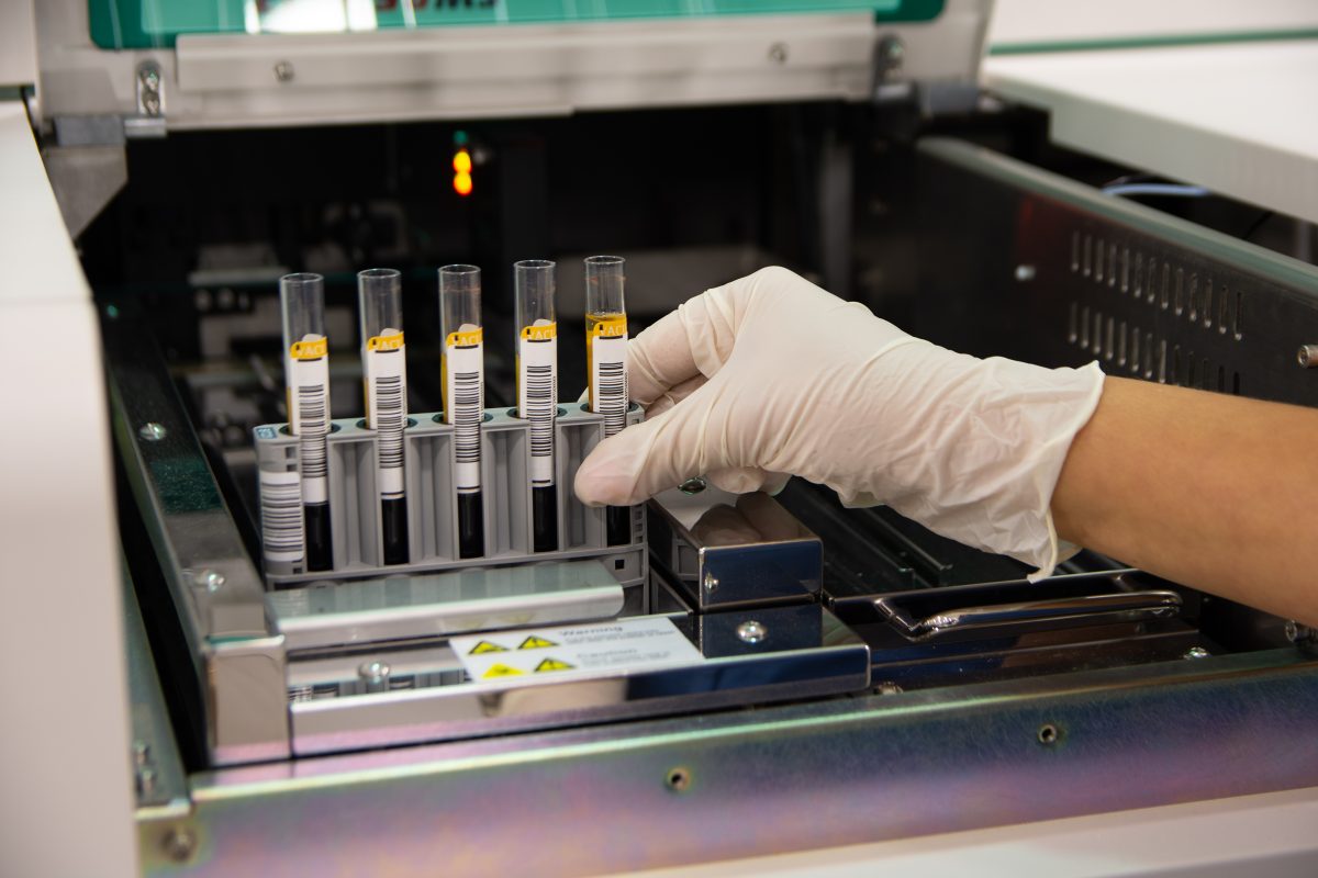 Lipidni status - Minmedik lab laboratorija | Laboratorija | Beograd, Zvezdara