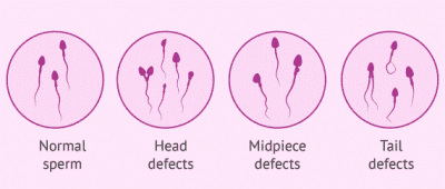 ANALIZA SPERME/SPERMOGRAM - Minmedik lab laboratorija | Laboratorija ...